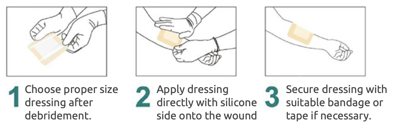 Silicone Silver Foam Dressing - Biotronix Healthcare Inc.