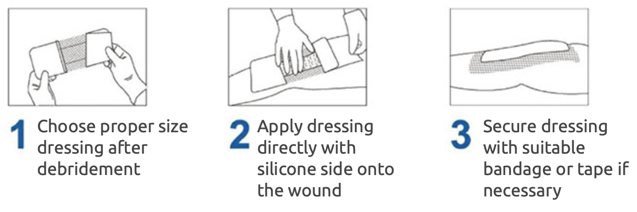 Silicone-Post-op-Dressings - Biotronix Healthcare Inc.